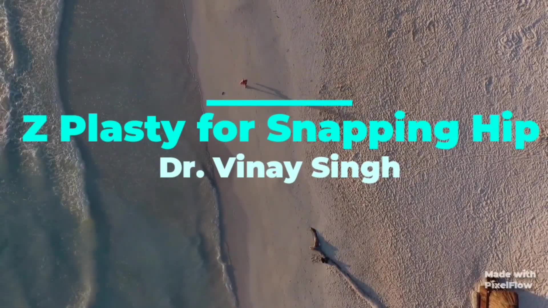 Hippocratic Method of Shoulder Reduction (Reduction in less than 5seconds)